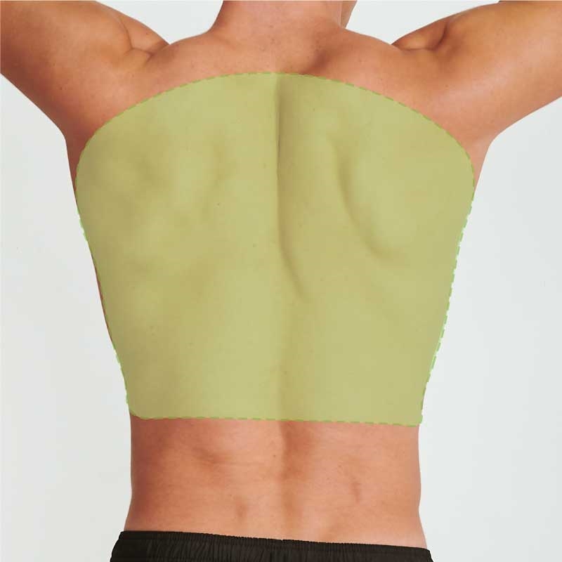 Results Laser Clinic, Australia's No.1 choice for laser hair removal ...